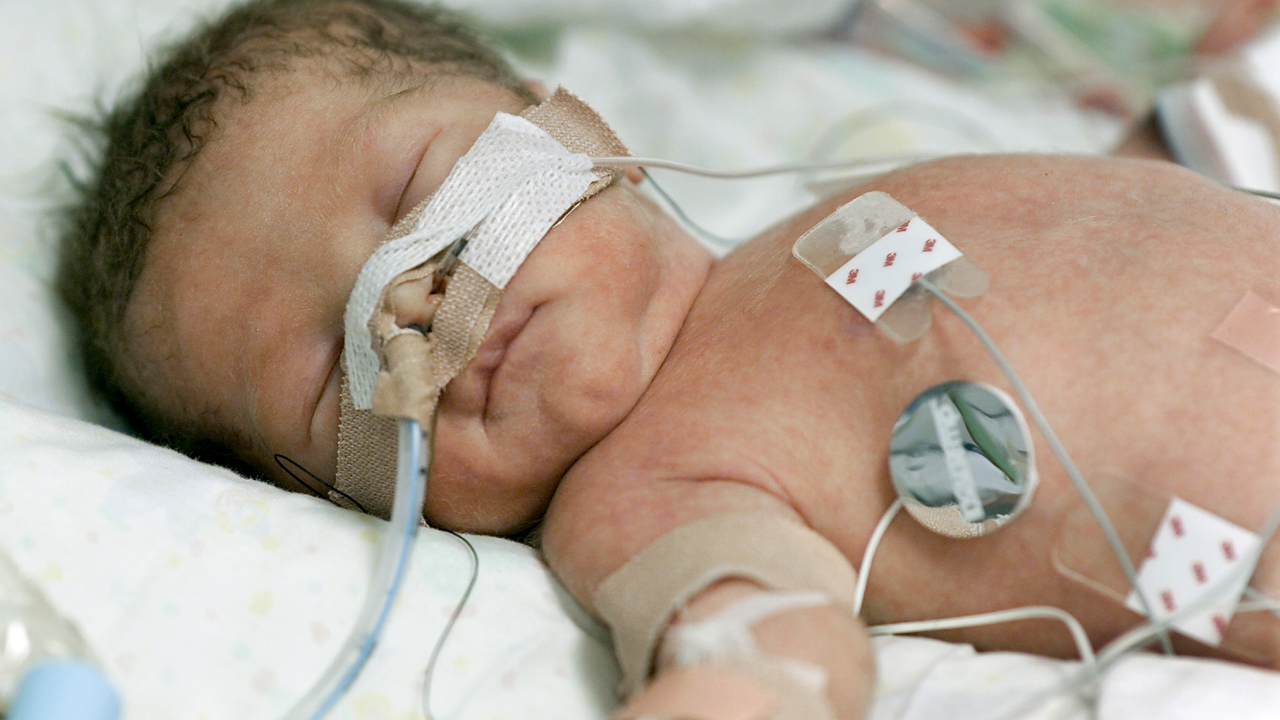 Stress Test explained | Victor Chang Cardiac Research Institute