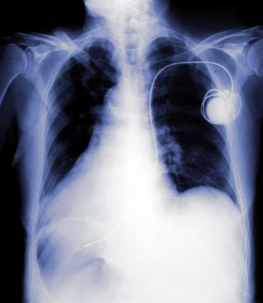 Australian Heart Disease Research - Victor Chang Cardiac Research Institute