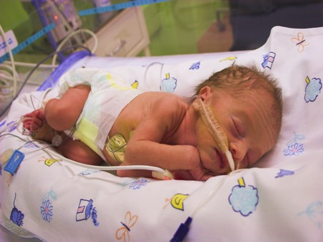 World-first discovery sheds new light on congenital birth defects ...