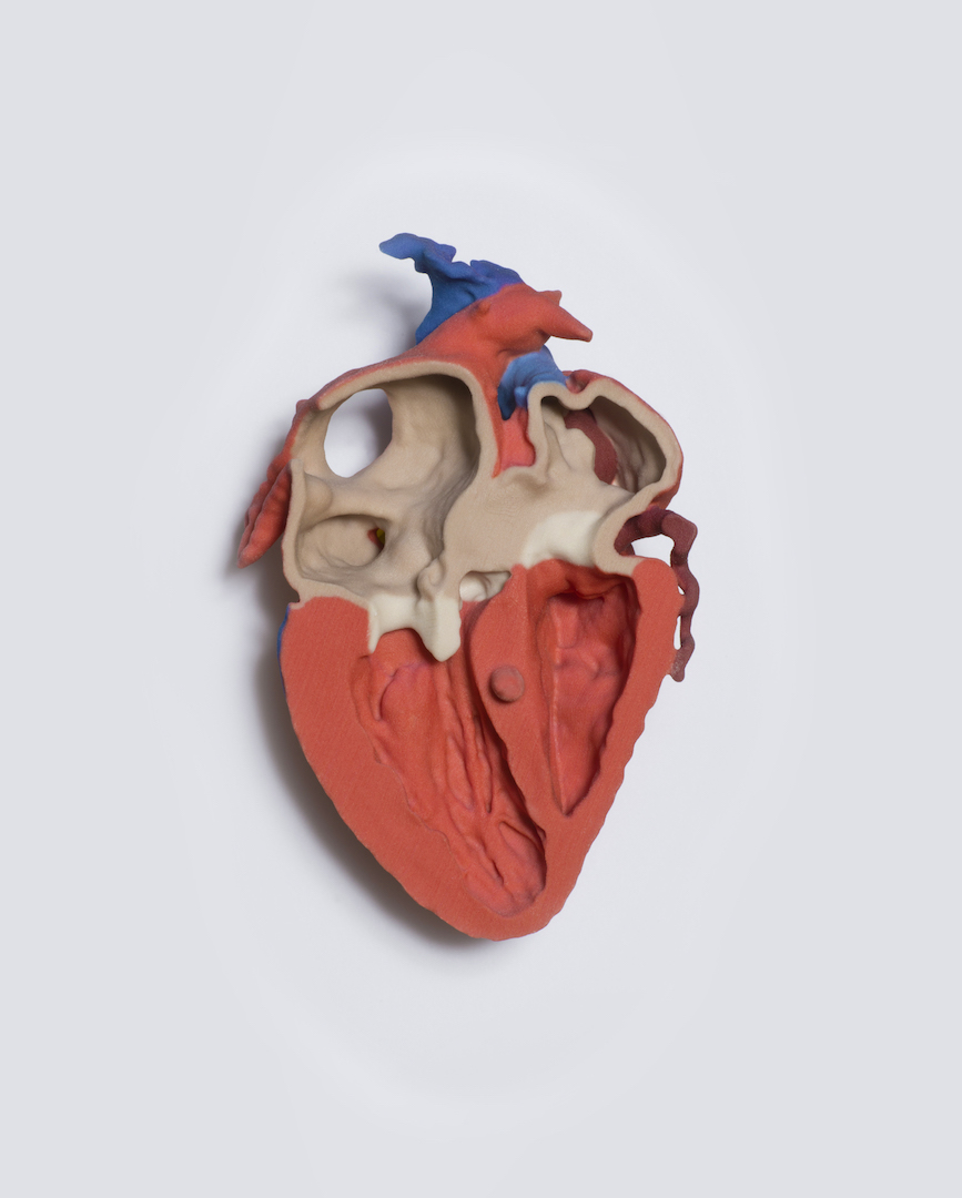 The Human Heart - Victor Chang Cardiac Research Institute