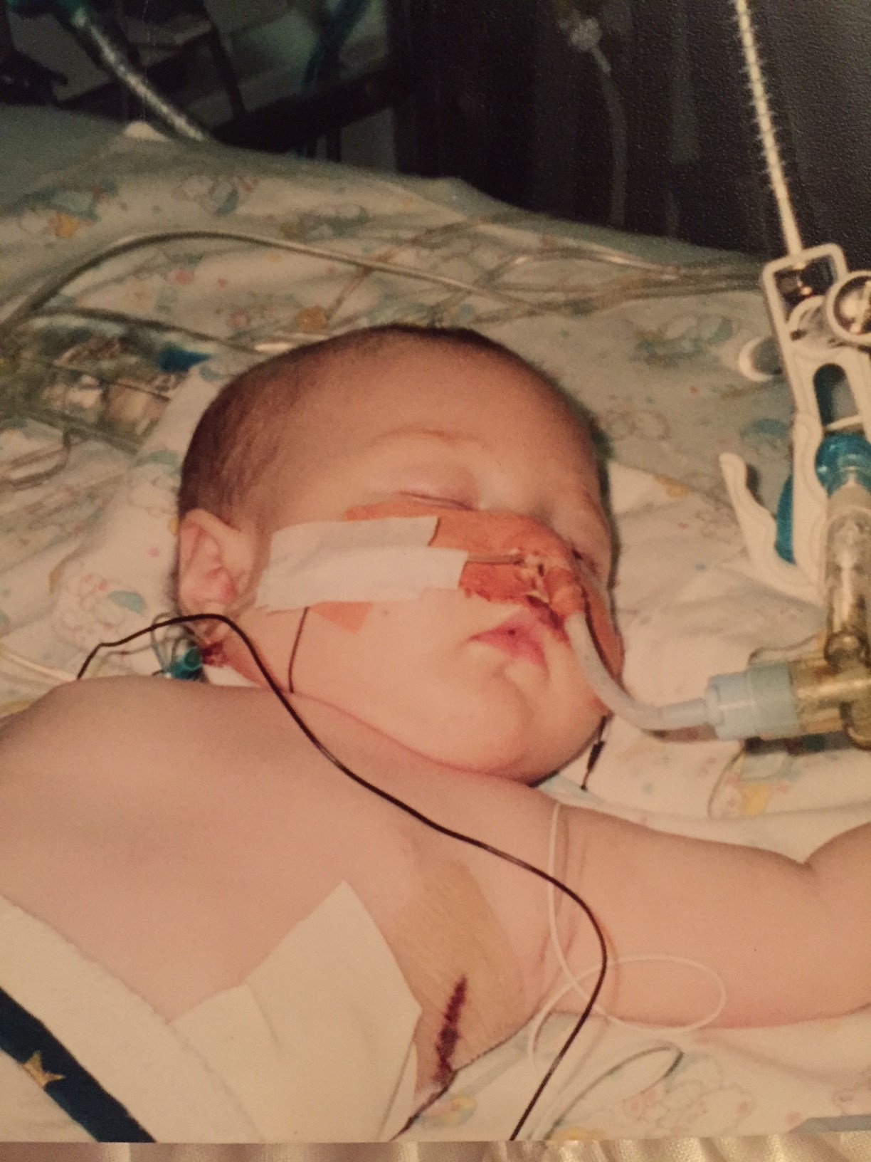 Riley's Story - CHD | Victor Chang Cardiac Research Institute