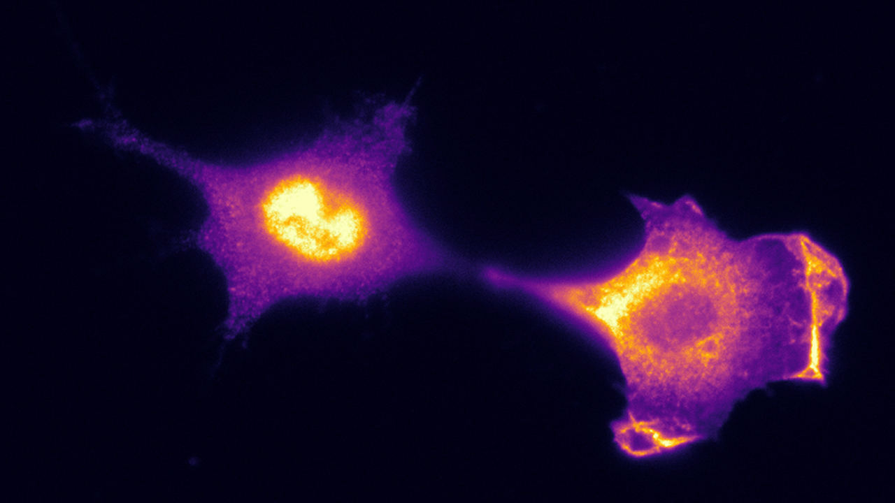 Dr Nicole Bryce | Victor Chang Cardiac Research Institute