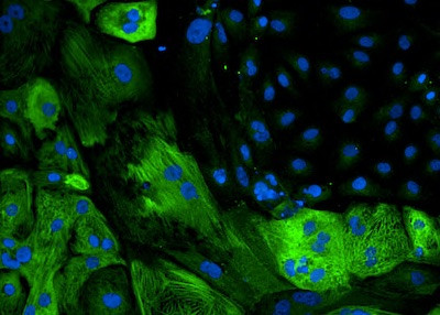 Micro Imaging Facility - Victor Chang Cardiac Research Institute