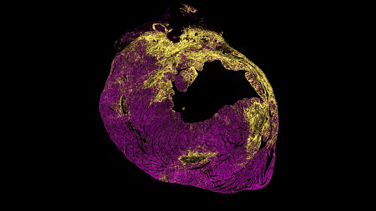 Australian Heart Disease Research - Victor Chang Cardiac Research Institute