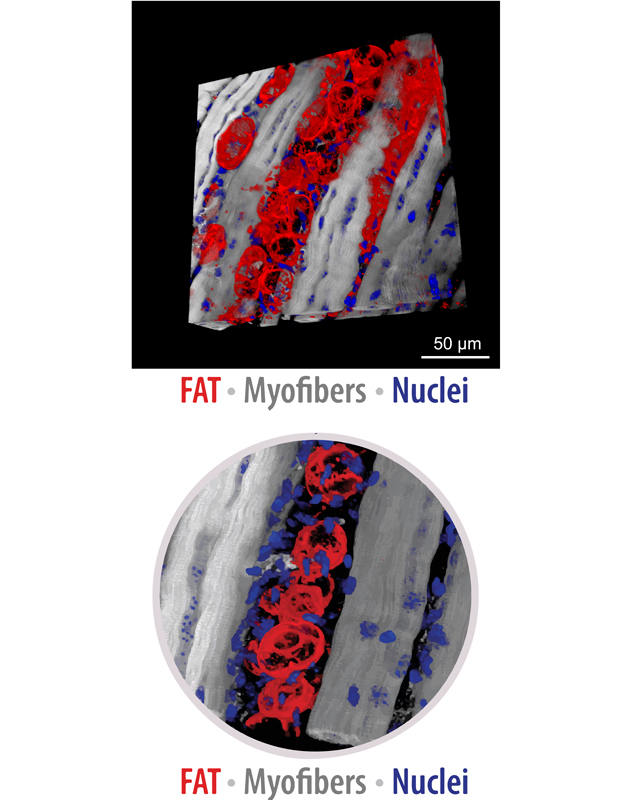 Hidden fat in muscles… | Victor Chang Cardiac Research Institute
